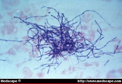 Actinomyces species - hyphae | ENvironmental inFOrmation